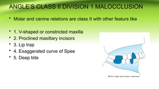 Angle’s classification of malocclusion. (2).pptx