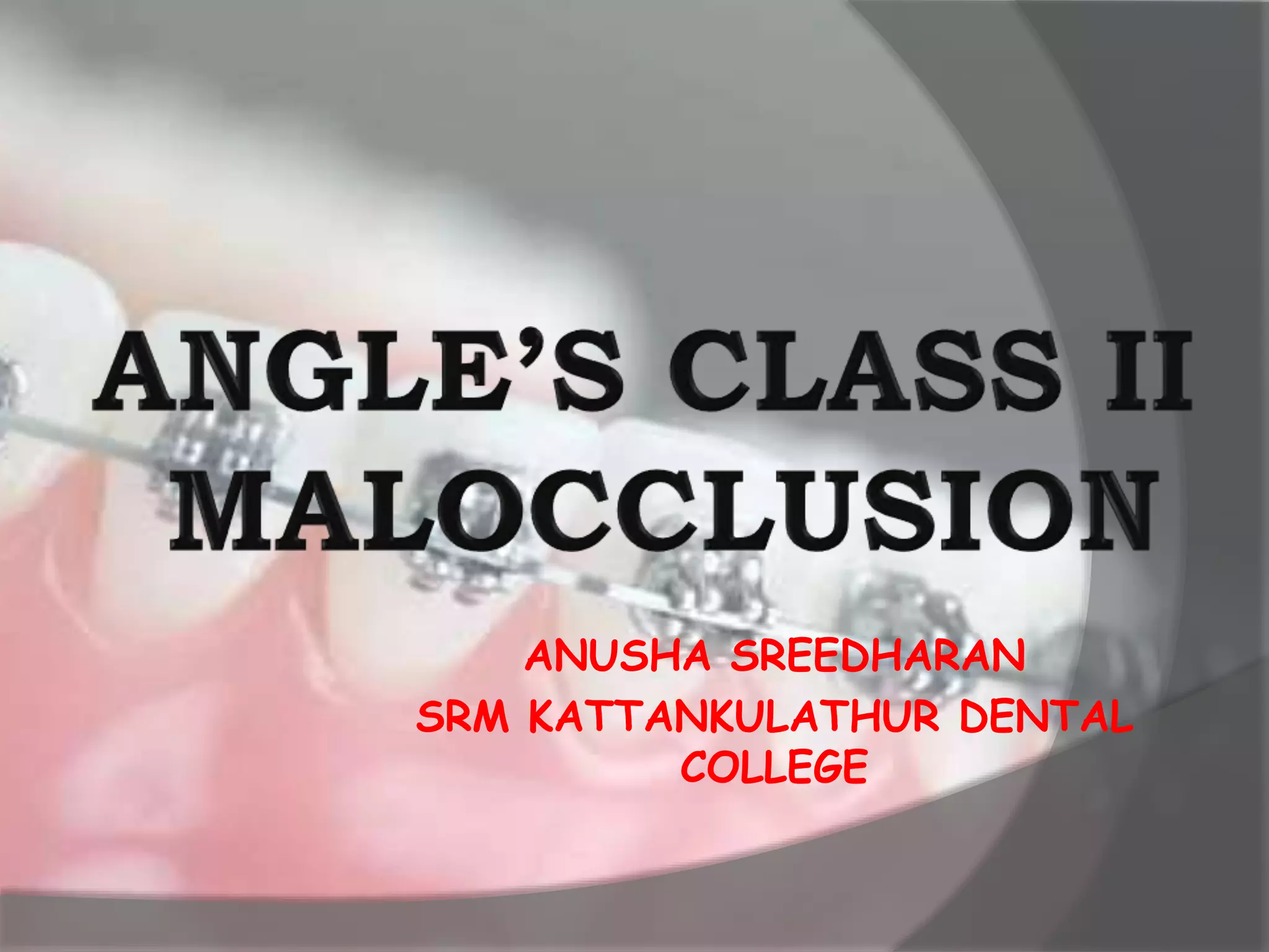 Angle’s class ii malocclusion | PPTX