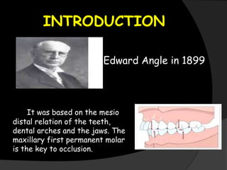 Angle’s class ii malocclusion | PPTX