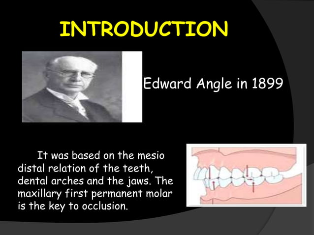 Angle’s class ii malocclusion | PPT