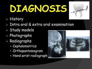 Angle’s class ii malocclusion | PPTX