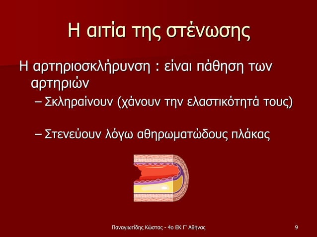 ΟΞΥ ΚΑΡΔΙΑΚΟ ΝΟΣΗΜΑ: Η ΣΤΗΘΑΓΧΗ | PPTX
