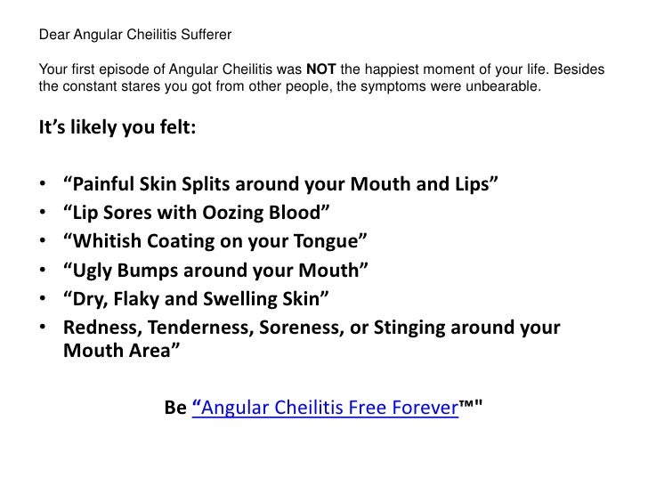 Angular cheilitis treatment