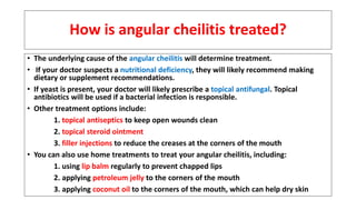 Severe Angular Cheilitis Treatment