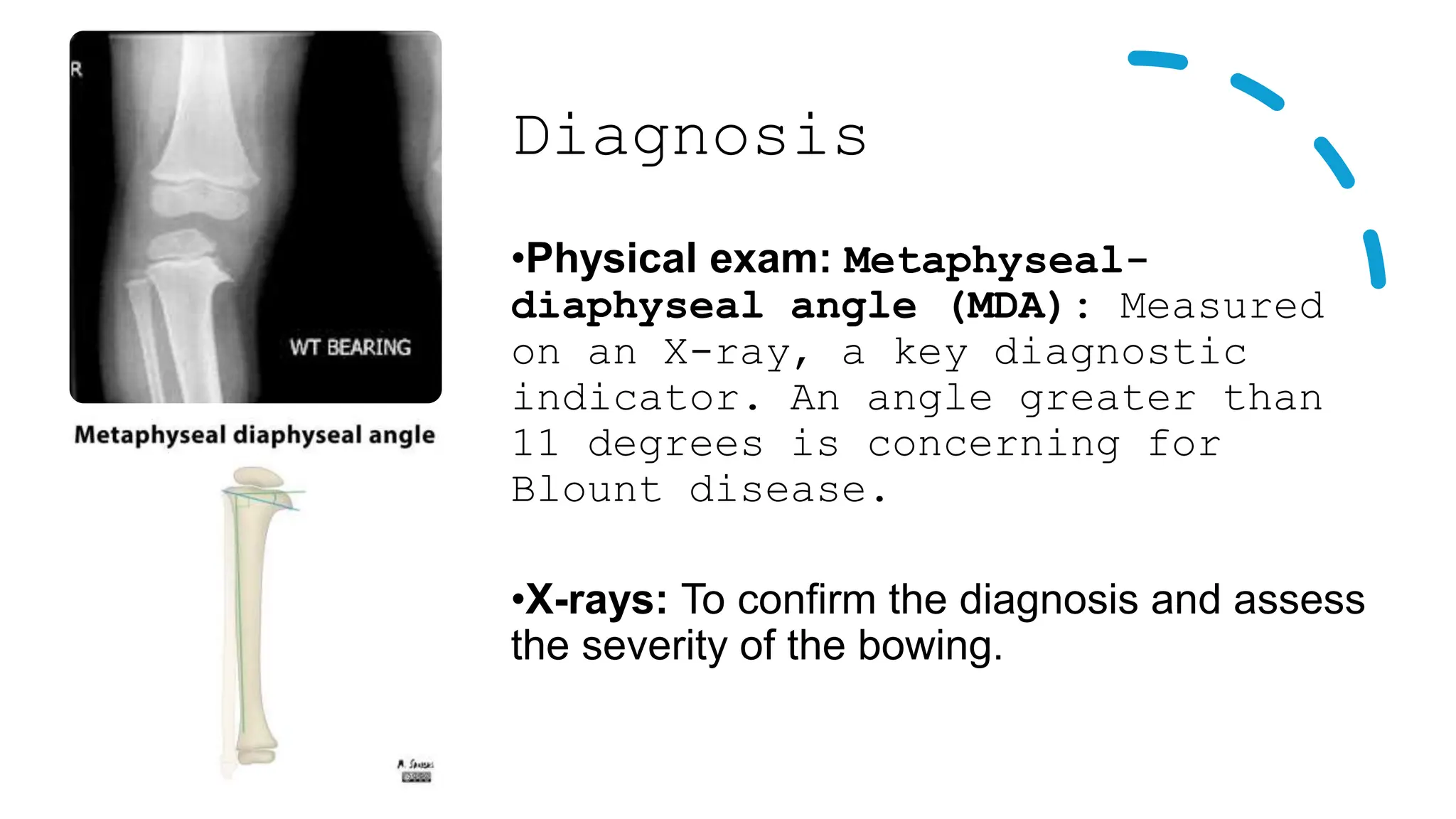 Angular deformities of the lower limp.pptx