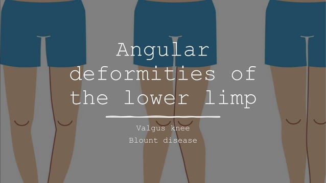 Angular deformities of the lower limp.pptx
