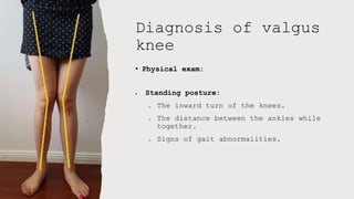 Angular deformities of the lower limp.pptx