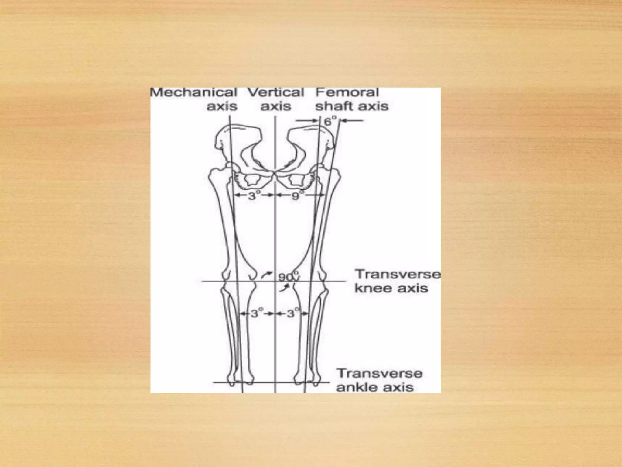 Angular Deformity | PPTX