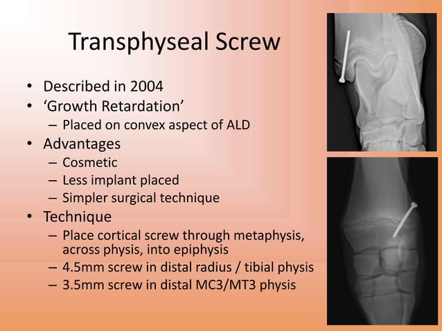 Angular limb deformity | PPT