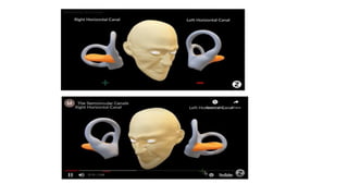 Angular movement in semicircular canal mechanism.pptx