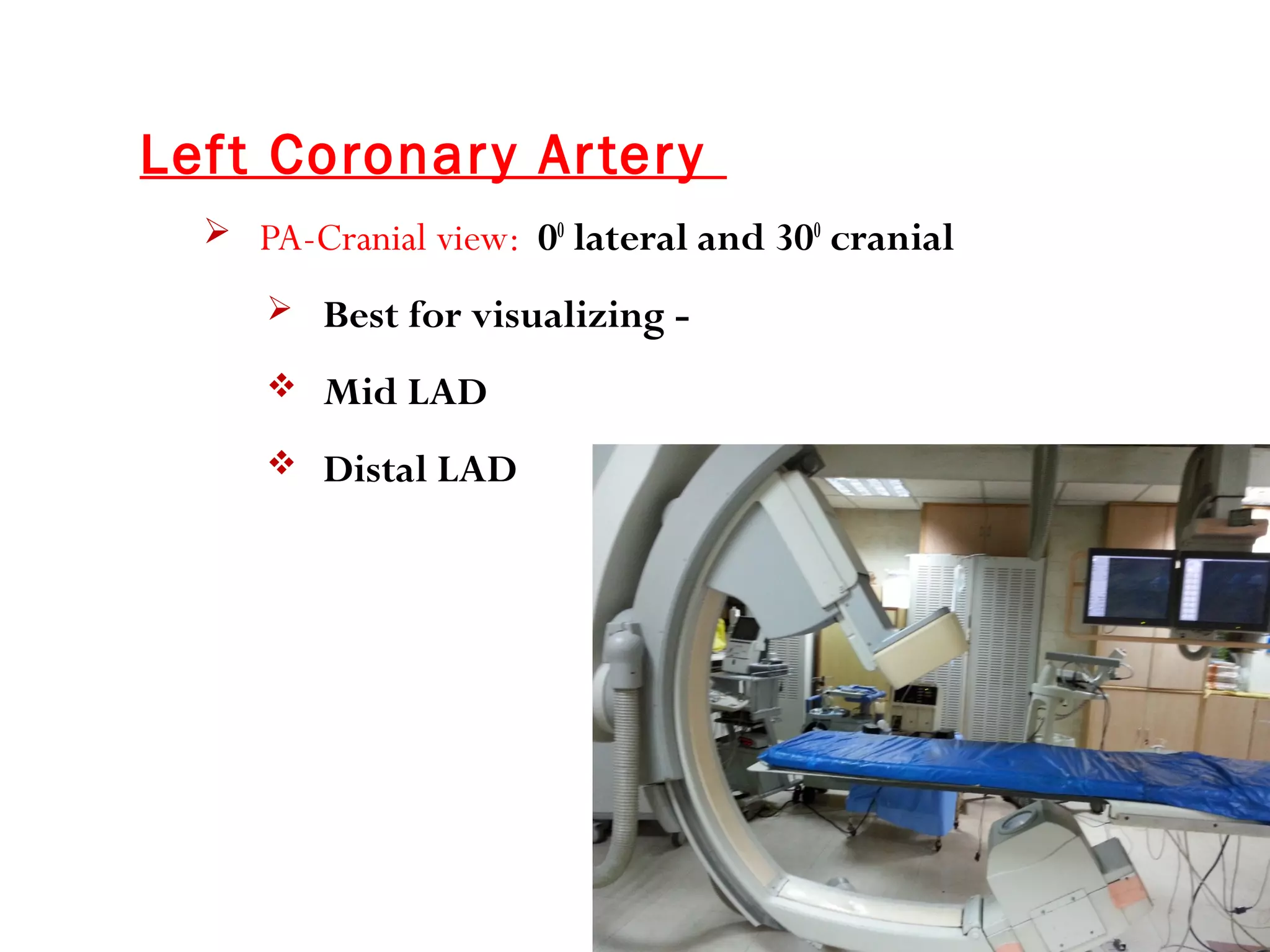 Angulated views in coronary angiography,an introductory lecture for ...