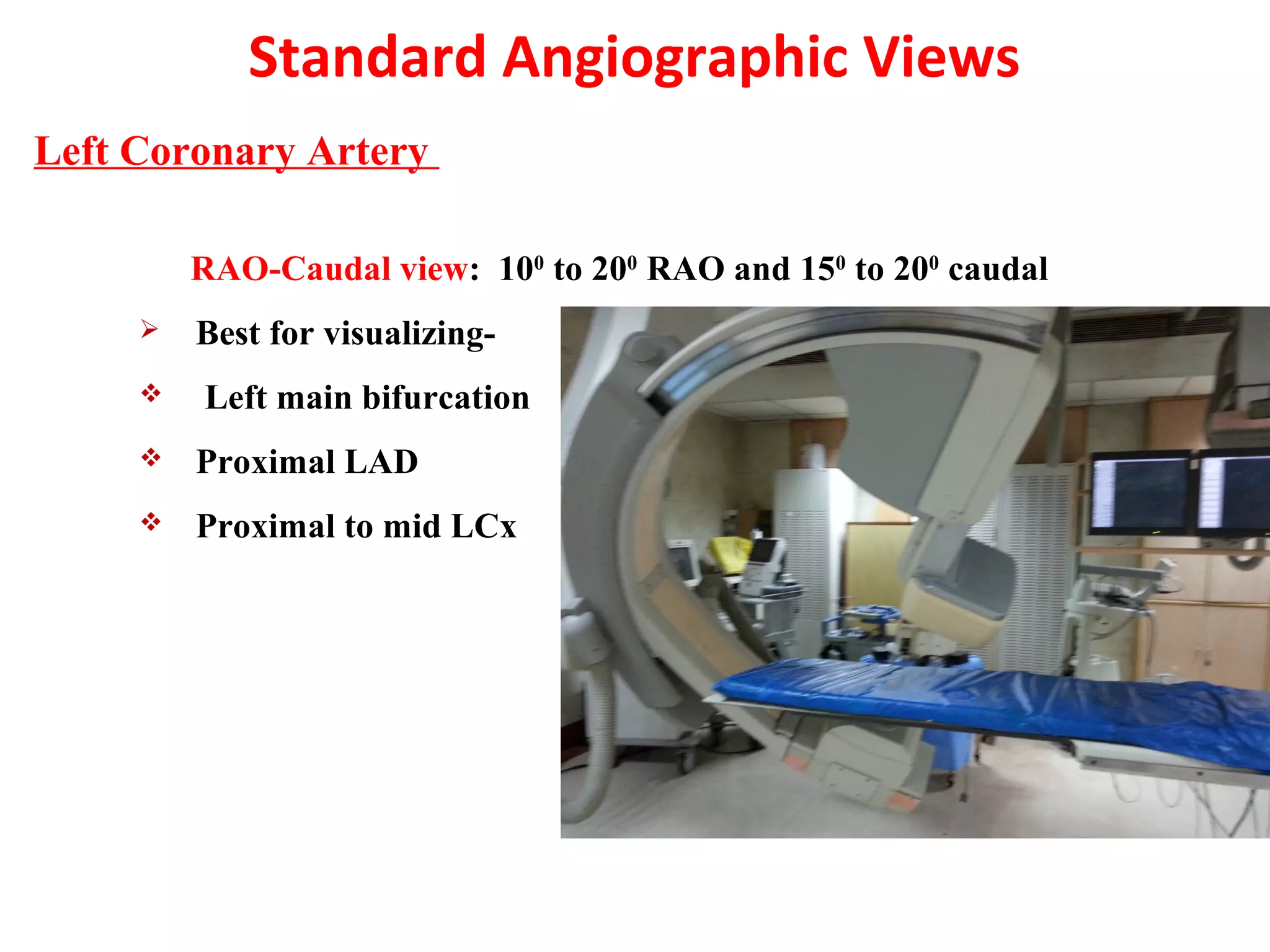 Angulated views in coronary angiography,an introductory lecture for ...