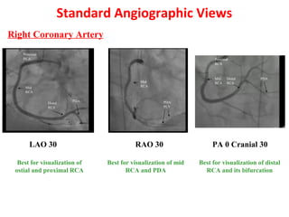 Angulated views in coronary angiography,an introductory lecture for ...