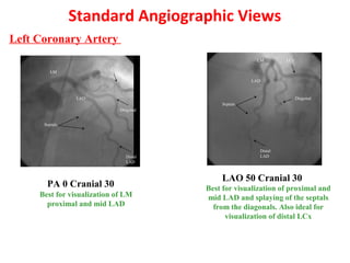 Coronary Angiography Views