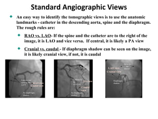Angulated views in coronary angiography,an introductory lecture for ...