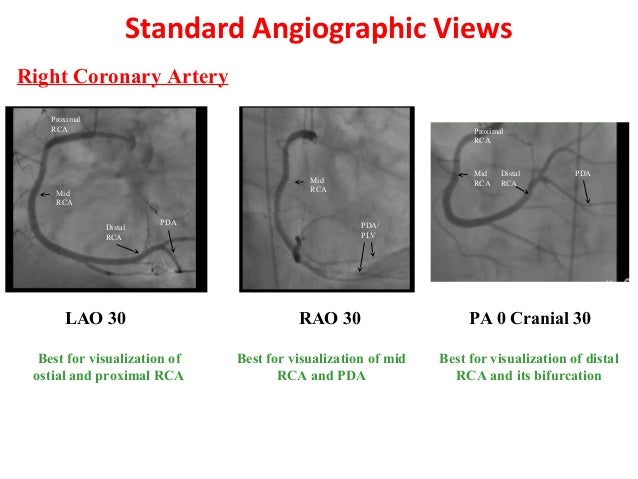 Angulated views in coronary angiography,an introductory lecture for c…