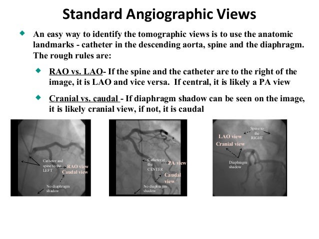 Angulated views in coronary angiography,an introductory lecture for c…