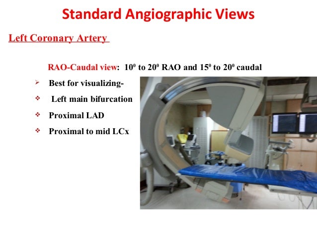 Angulated views in coronary angiography,an introductory lecture for c…