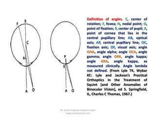 Angulo kappa en oftalmologia | PPTX