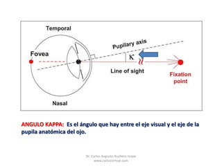 Angulo kappa en oftalmologia | PPTX