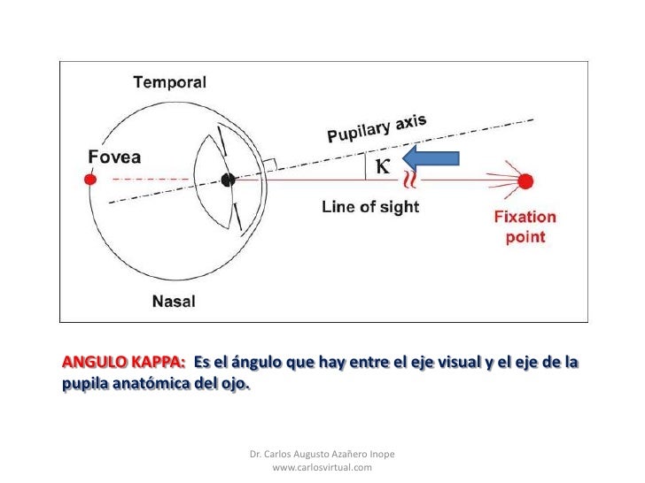 Angulo kappa en oftalmologia