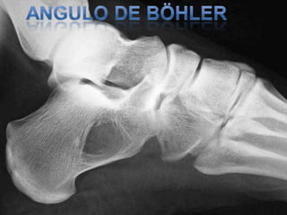 ANGULOMETRIA.ppt