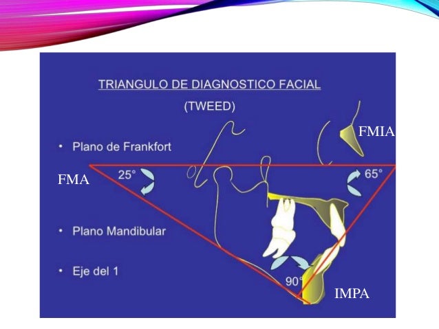 Angulos cefalometricos