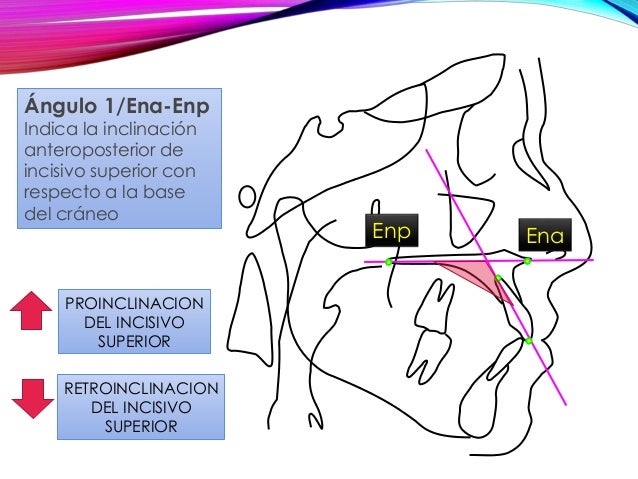 Angulos cefalometricos