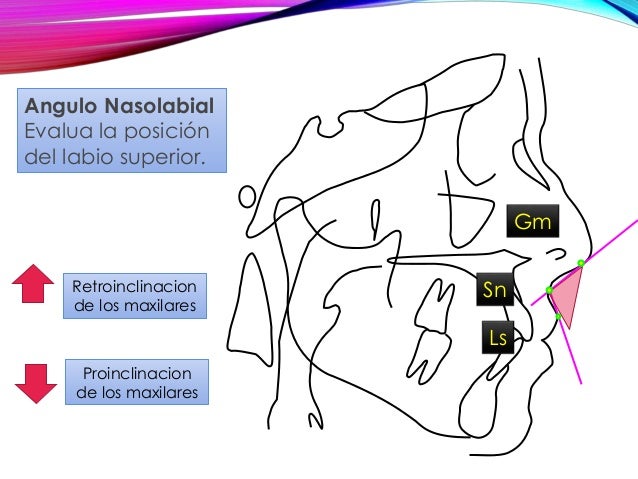 Angulos cefalometricos