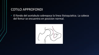 Angulos en traumatologia | PPTX