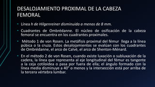 Angulos en traumatologia | PPTX