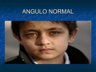 Angulos fotograficos | PPT