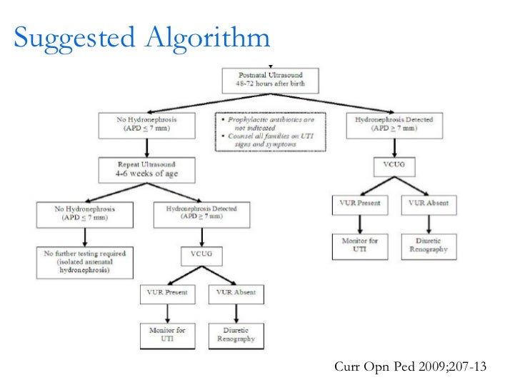 Antenatal Hydronephrosis