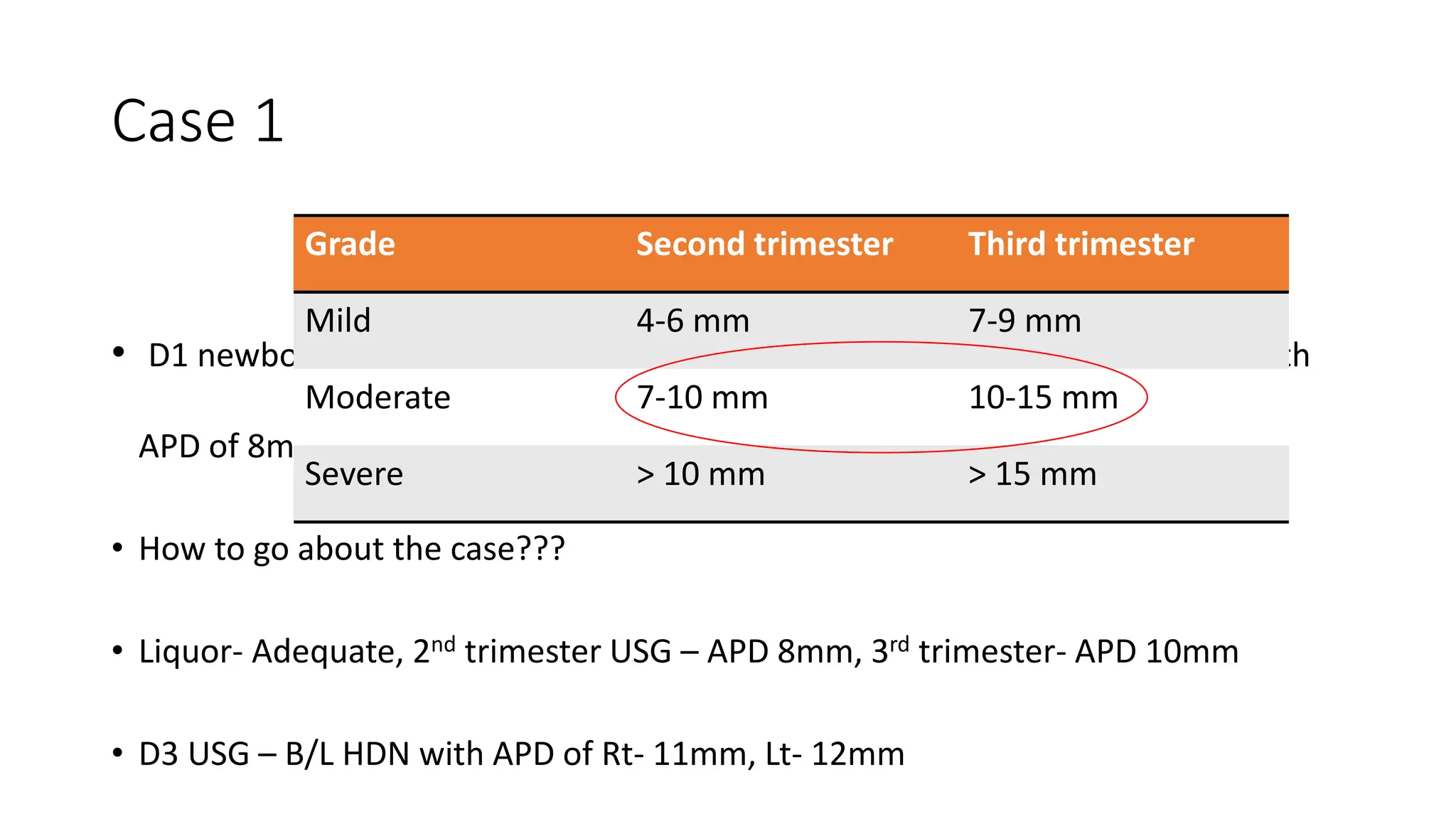 Antenatalhydronephrosis 2022may (1).pptx