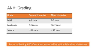 Antenatalhydronephrosis 2022may (1).pptx