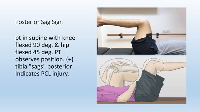 Orthopedic test for the Knee | PPTX