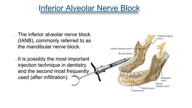 Inferior Alveolar Nerve Block Anesthetic Technique | PPTX | Ear, Nose ...