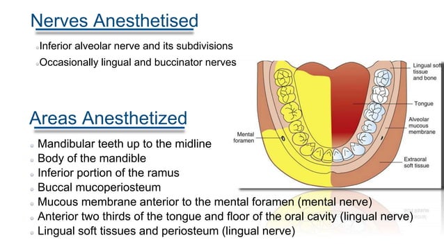 Inferior Alveolar Nerve Block Anesthetic Technique | PPTX | Ear, Nose ...