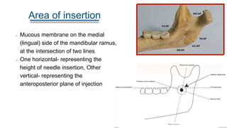 Inferior Alveolar Nerve Block Anesthetic Technique | PPTX