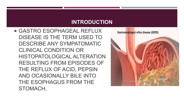 CASE STUDY GERD | PPTX
