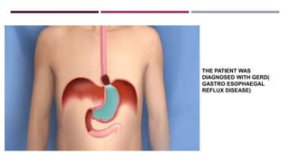 CASE STUDY GERD | PPTX