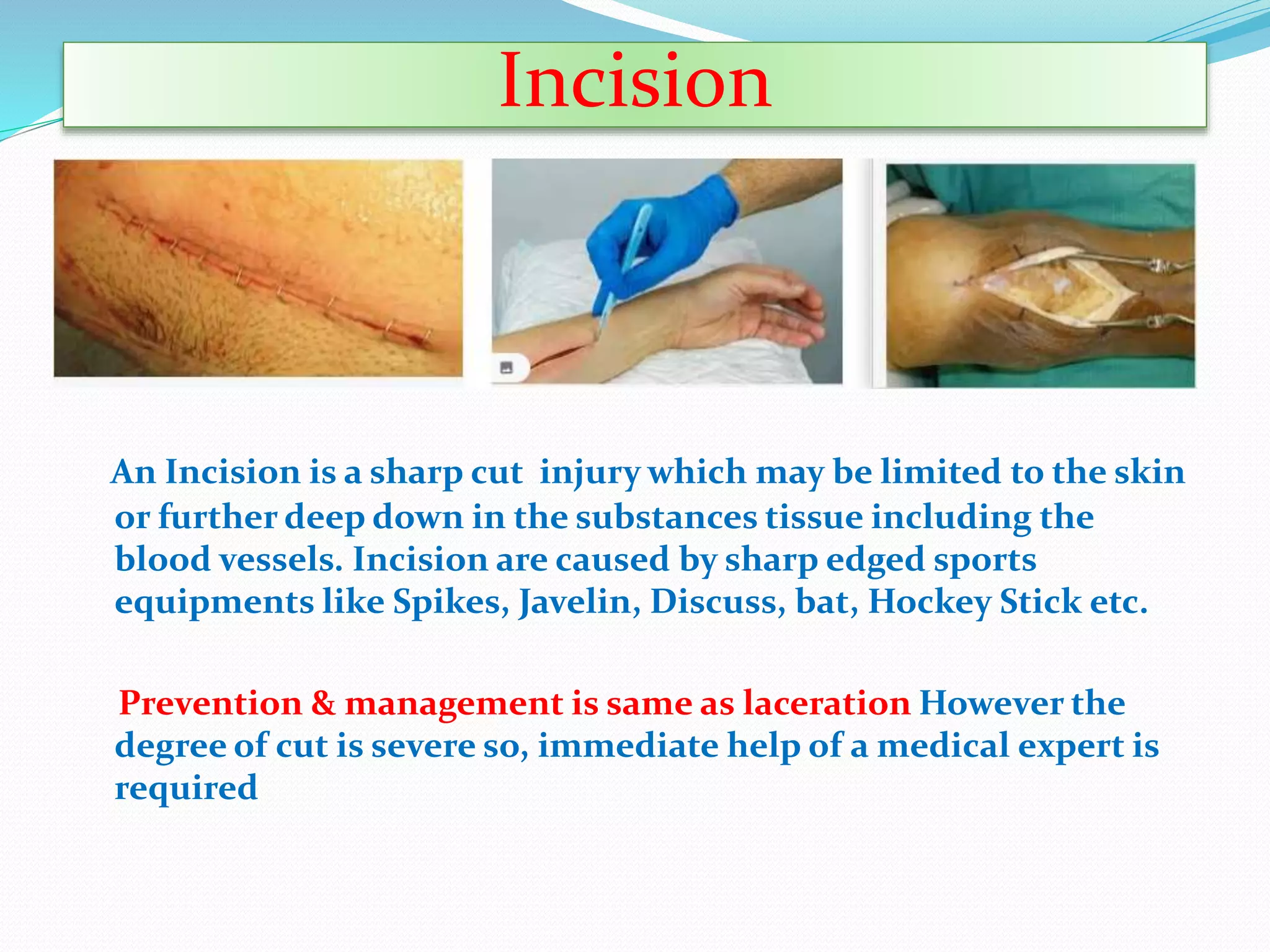 Anil dahiya Class XII chapter -7 Physiology & injuries in sports | PPTX