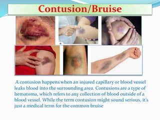 Anil dahiya Class XII chapter -7 Physiology & injuries in sports | PPTX ...