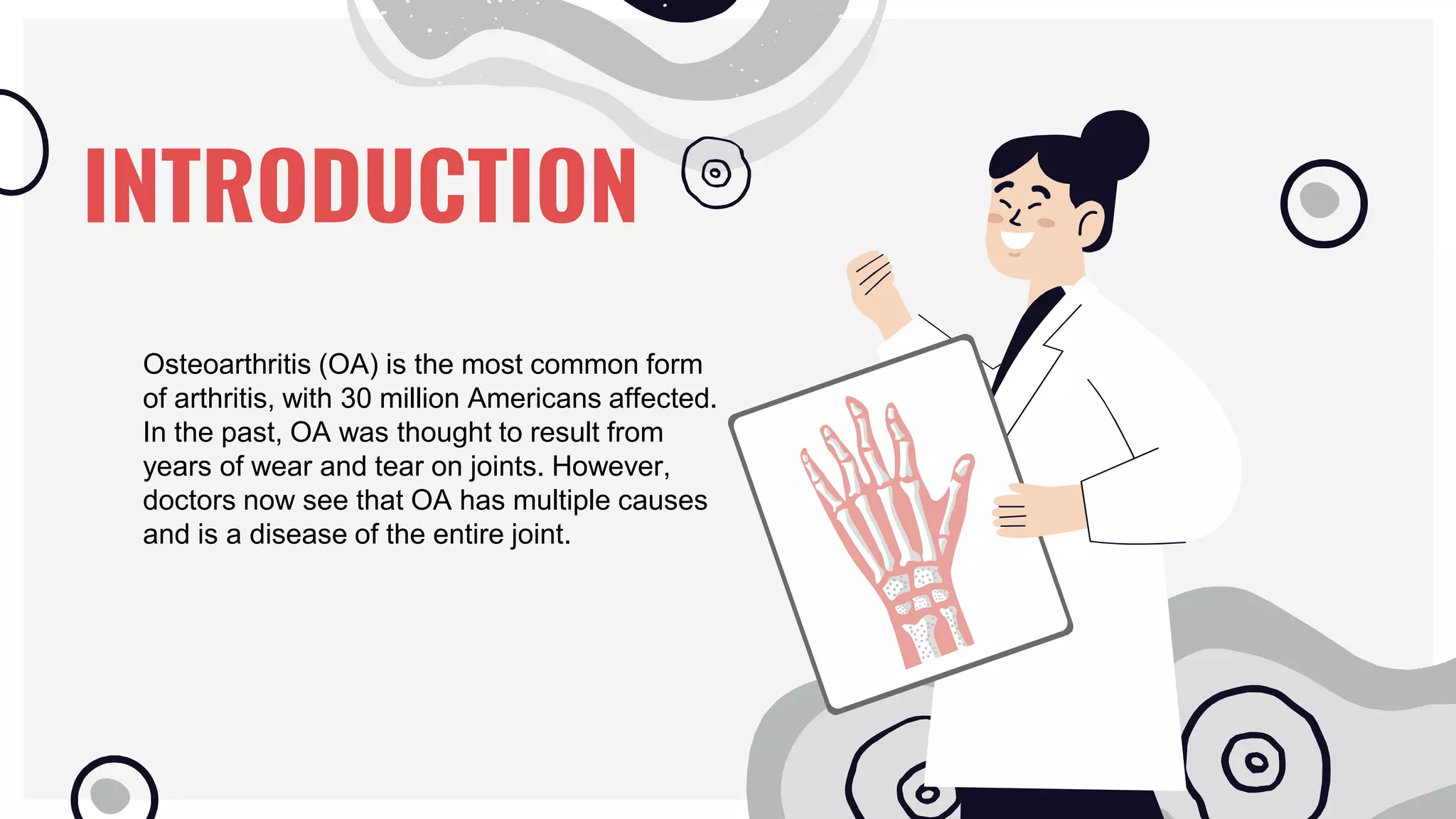 CASE STUDY ON OSTEOARTHRITIS | PPTX
