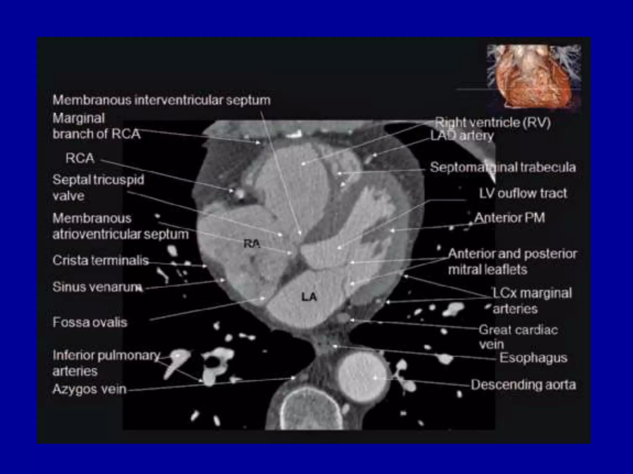 An imaging atlas of mdct angiography Dr. Muhammad Bin Zulfiqar | PPT