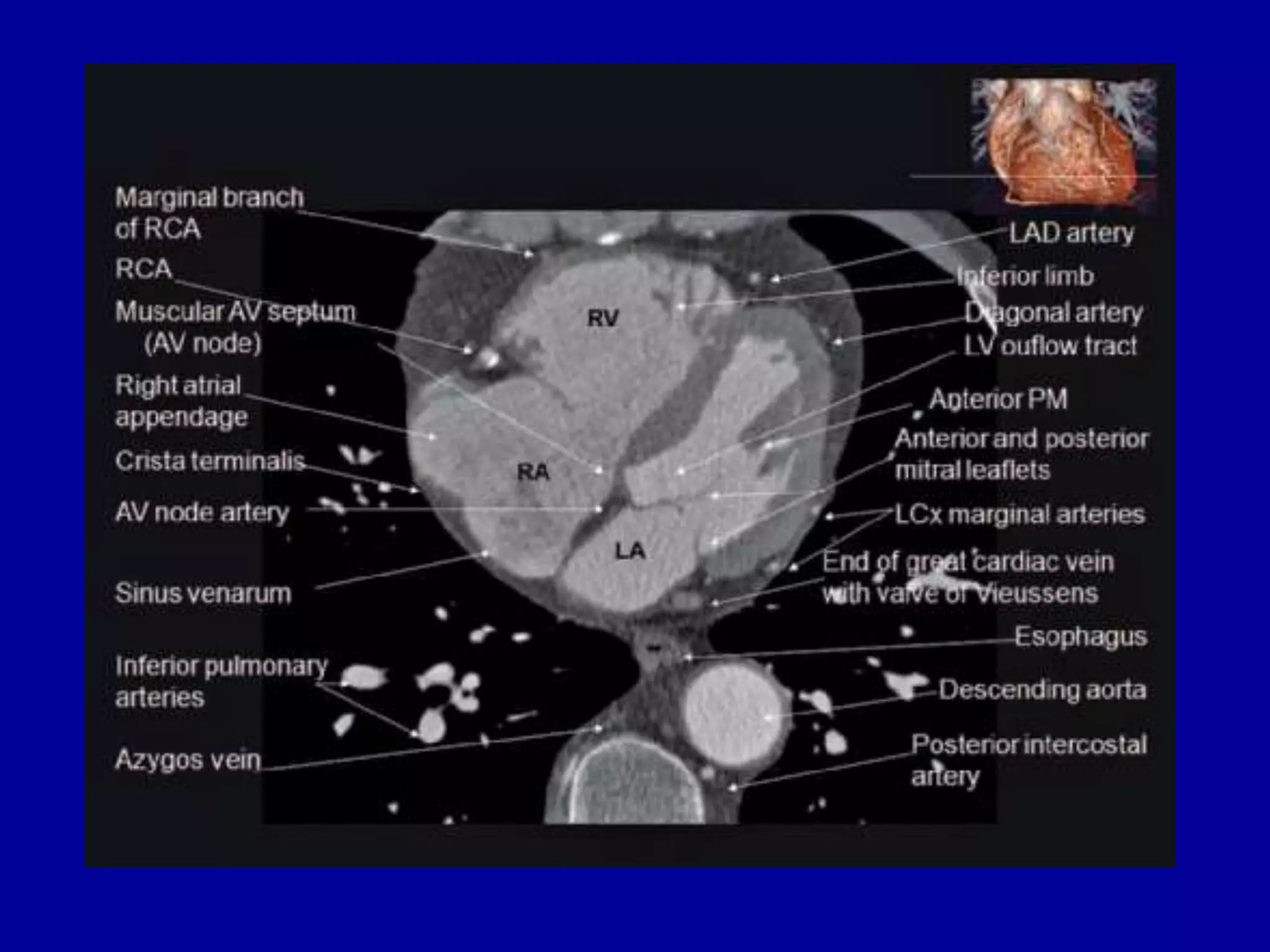 An imaging atlas of mdct angiography Dr. Muhammad Bin Zulfiqar | PPT