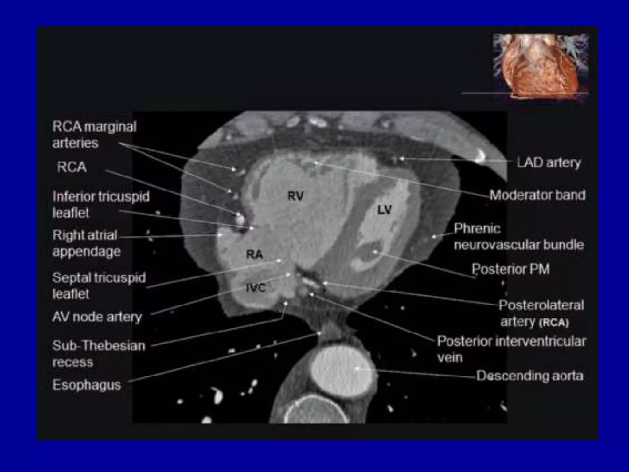 An imaging atlas of mdct angiography Dr. Muhammad Bin Zulfiqar | PPT
