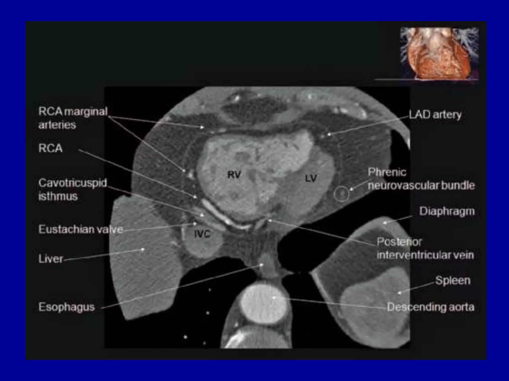 An imaging atlas of mdct angiography Dr. Muhammad Bin Zulfiqar | PPT