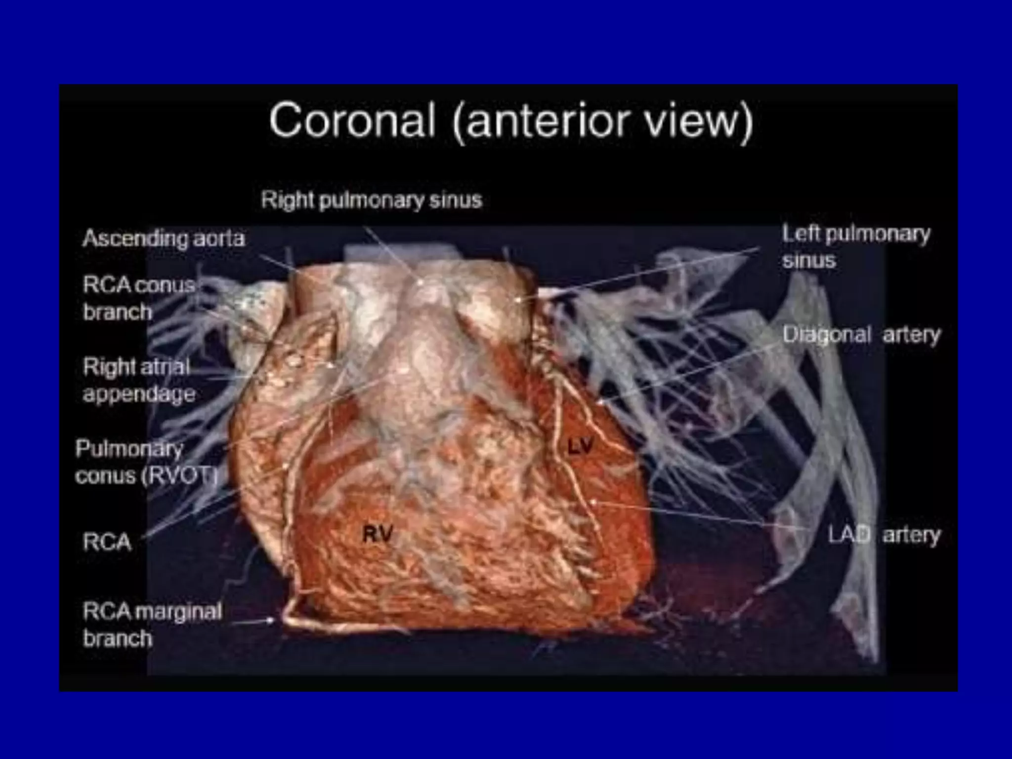 An imaging atlas of mdct angiography Dr. Muhammad Bin Zulfiqar | PPT