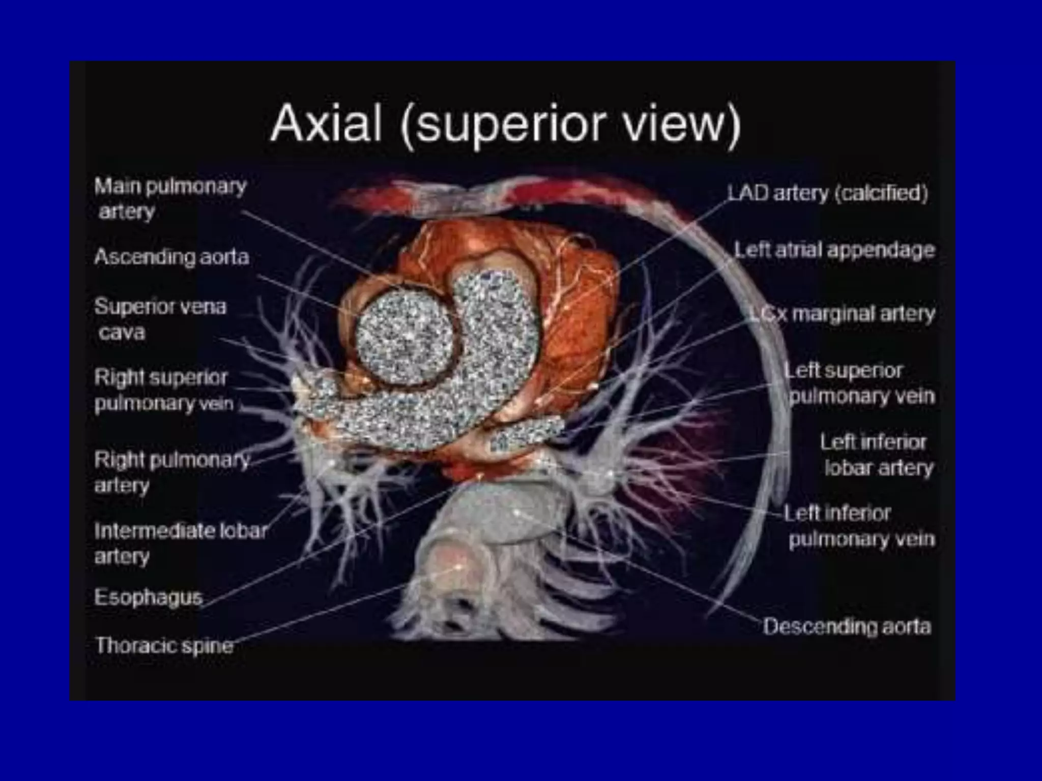 An imaging atlas of mdct angiography Dr. Muhammad Bin Zulfiqar | PPT